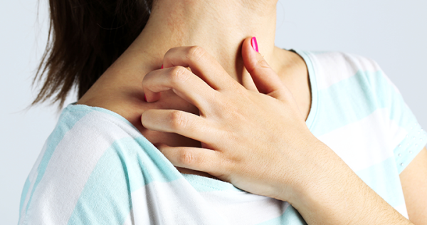 5 choses à savoir sur l'allergie au soleil | MMJ