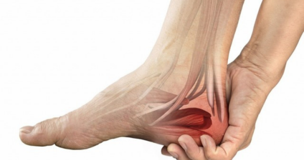 La talalgie, quand le talon vous fait souffrir | MMJ